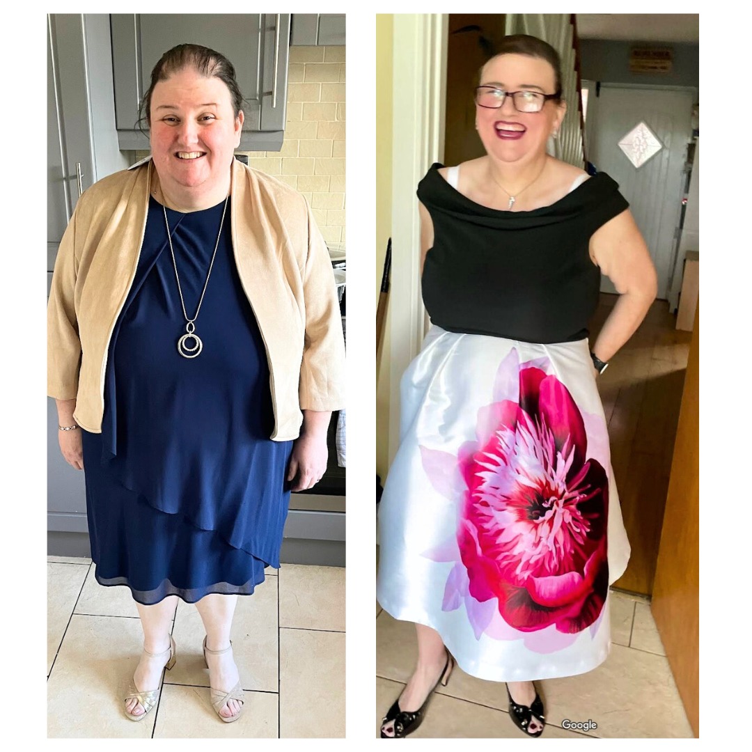 Weight Loss Surgery in Dublin - Blackrock WeightCare